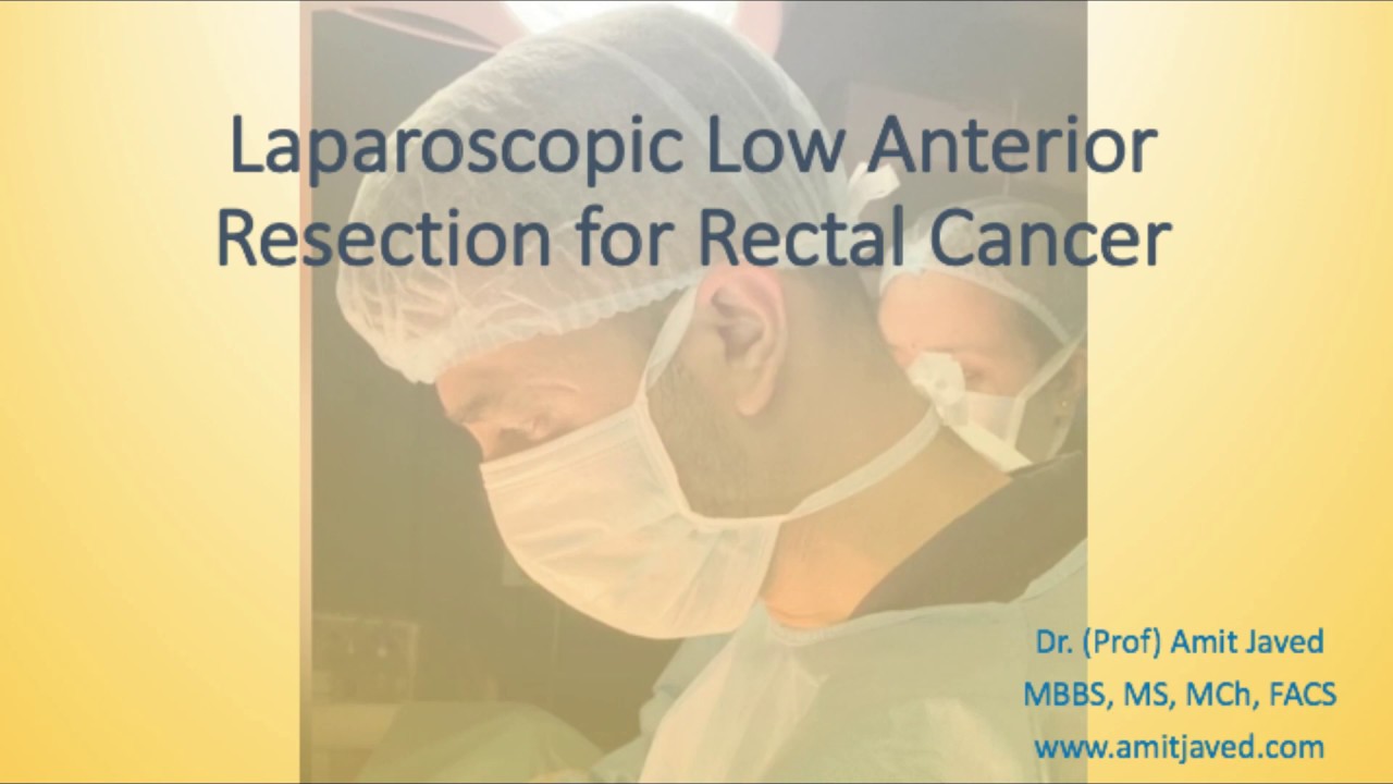 Laparoscopic Low Anterior Resection Surgery For Rectal Cancer By Dr