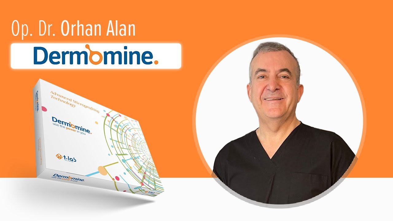 Op. Dr. Orhan Alan ile T-LAB Dermomine Mikro Greft Kit Uygulaması - YouTube