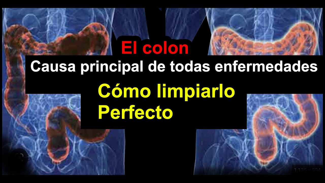 El colon! causa principal de todas enfermedades - Cómo limpiarlo ...