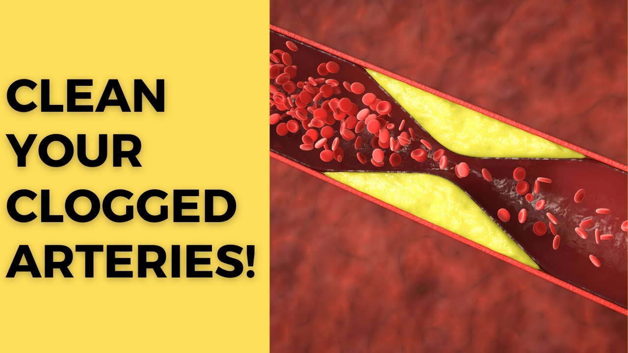 7 Foods That Help Clean Clogged Arteries Naturally - YouTube