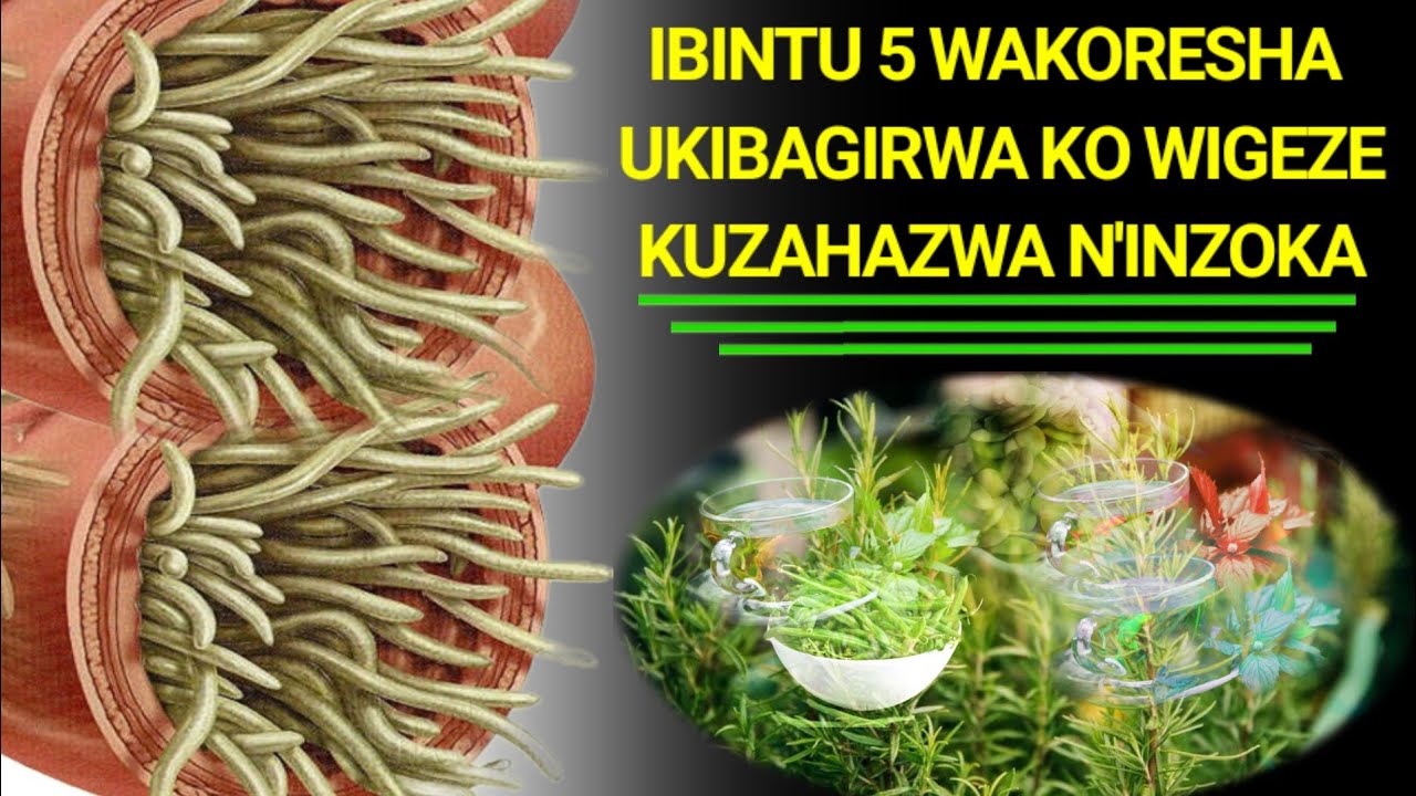 IMITI ITANU GUSA IKWIBAGIZA KO URWAYE INZOKA IZI NA ZIRIYA CYANE CYANE ...