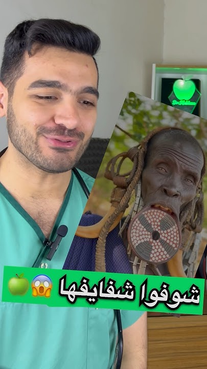 شوفوا شفايفها 😱🍏 دكتورنبهان Learning Youtube
