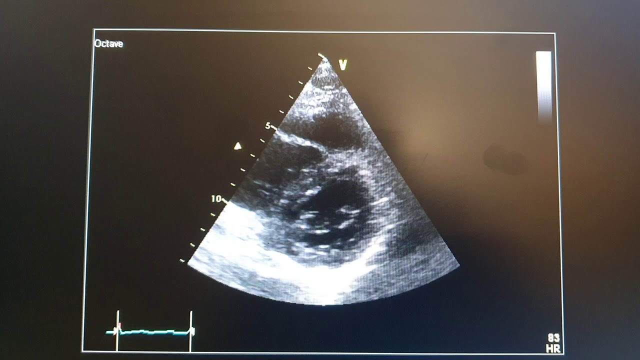 Moderator Band - YouTube