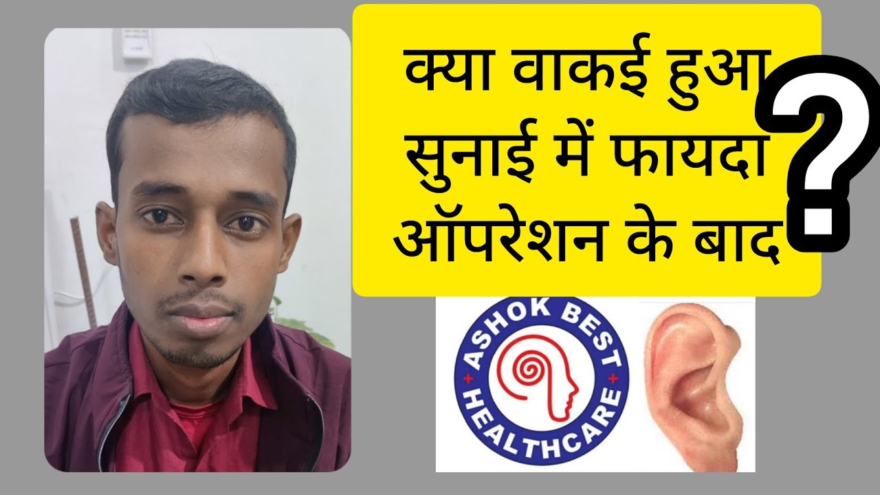 क्या वाकई सुनाई में फायदा हुआ दूरबीन से कान के ऑपरेशन के बाद