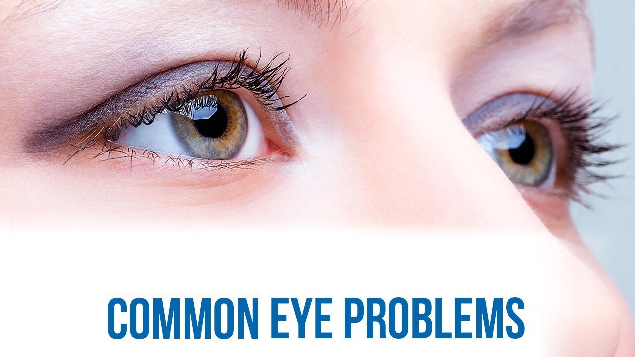 Common Eye Problems (English) - YouTube