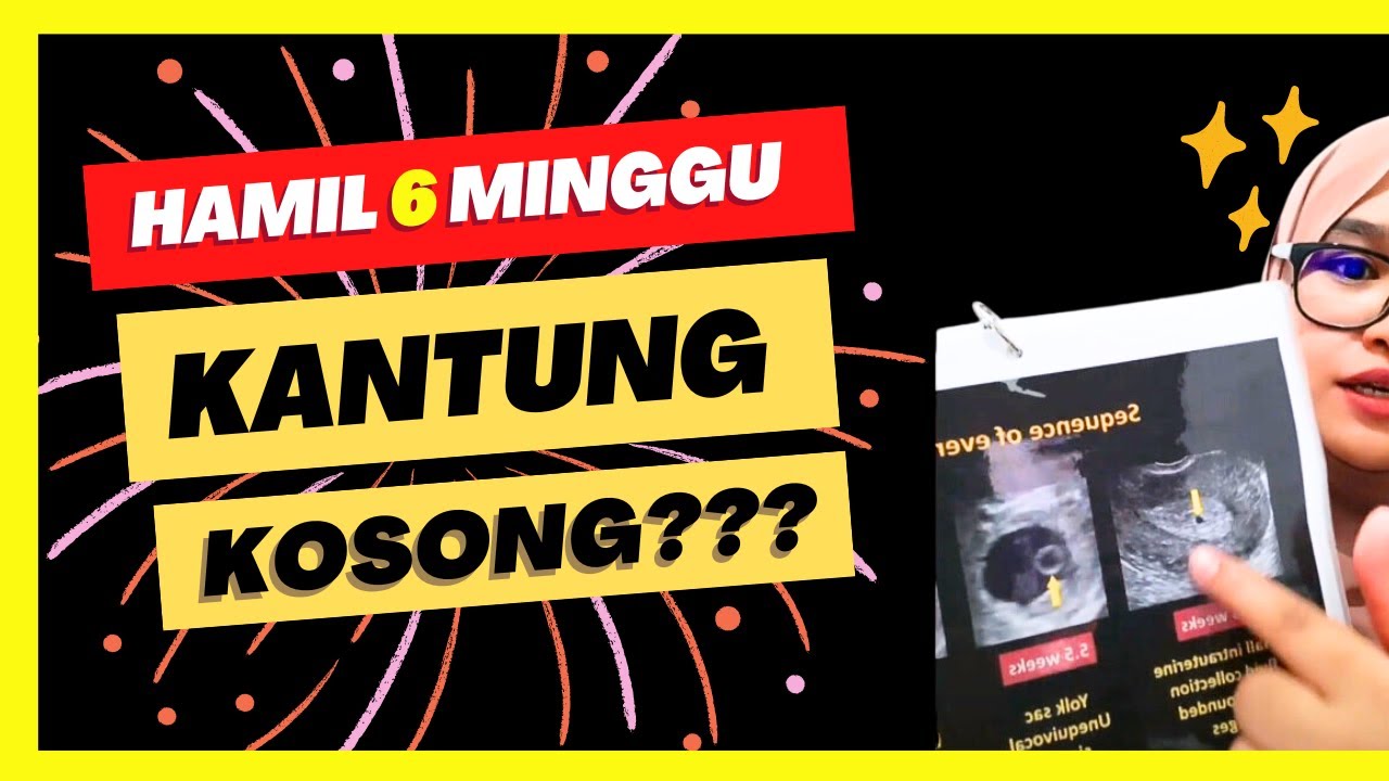HAMIL 6 MINGGU Tapi Kantung Kosong? UPT Positif Tapi SCAN Kantung Janin ... HAMIL 6 MINGGU Tapi Kantung Kosong? UPT Positif Tapi SCAN Kantung Janin ...
