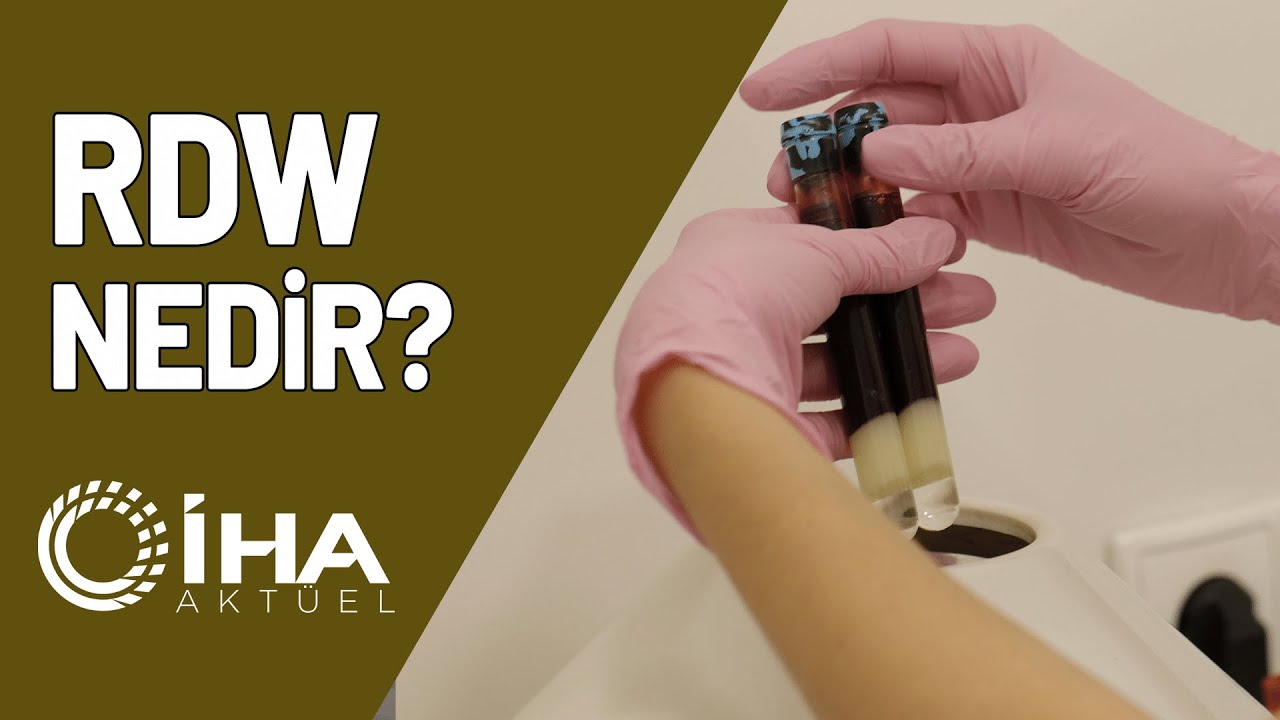 RDW Nedir - YouTube