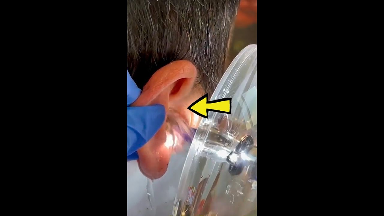 Satisfying Ear Cleaning - YouTube