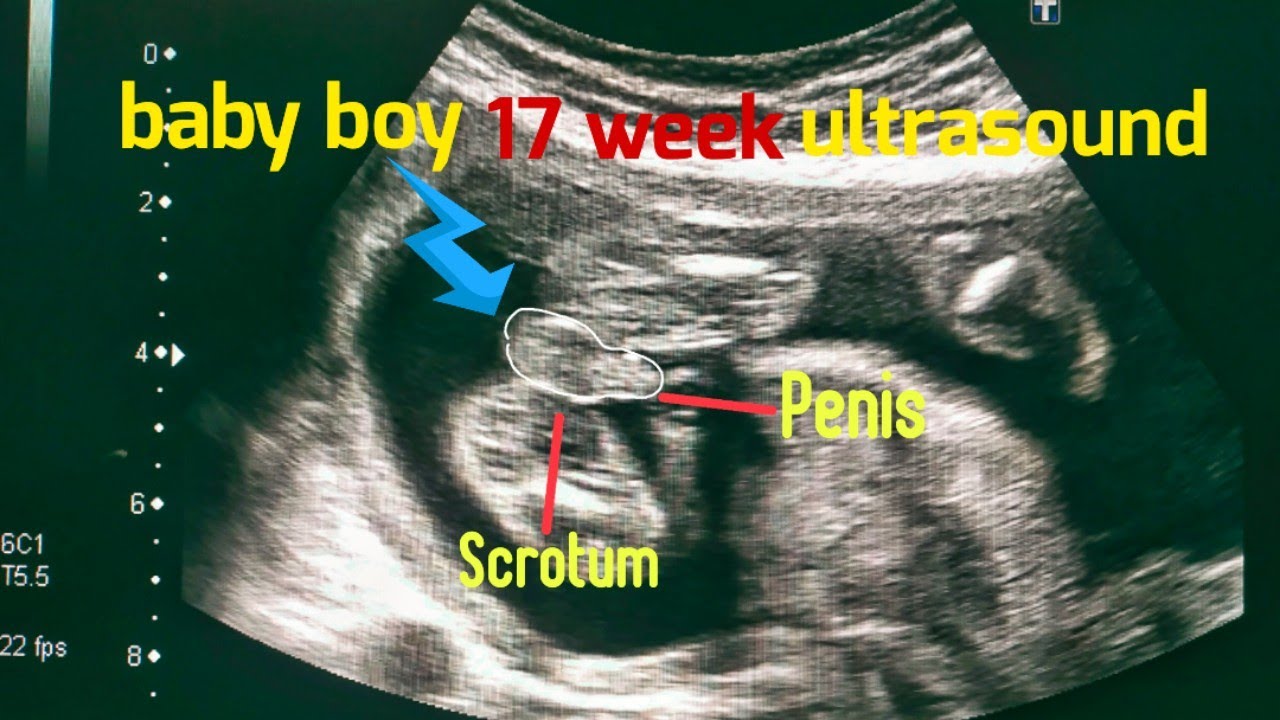 17 Week Ultrasound - Boy Baby! - YouTube