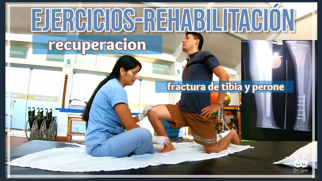 Ejercicios-rehabilitación recuperación de fractura de tibia y peroné ...