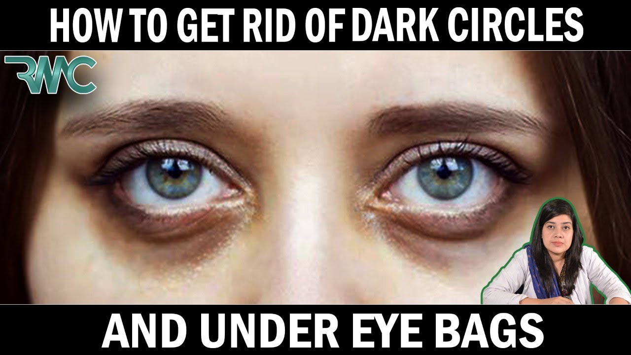 Dark Circle| By Dr Nazia Dermatologist | Rehman Medical Center ...