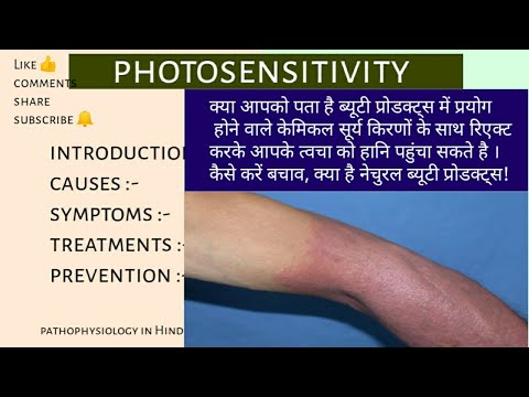 What is #Photosensitivity | sunburn | causes, symptoms, treatment ...