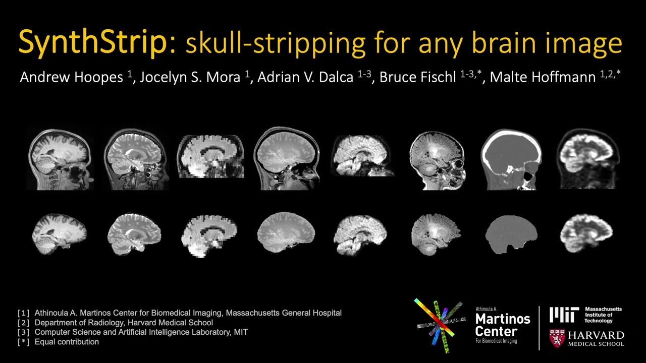 SynthStrip: Skull-Stripping for Any Brain Image - YouTube