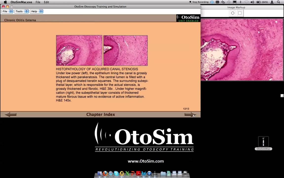 耳鏡訓練模擬 OtoSim™ Software Tour - YouTube