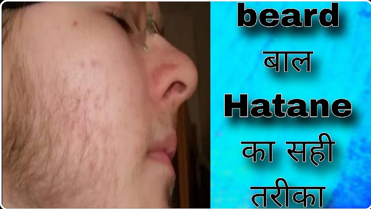 कम age मैं beard आ जाये तो करे यह काम | early beard problem solution - YouTube