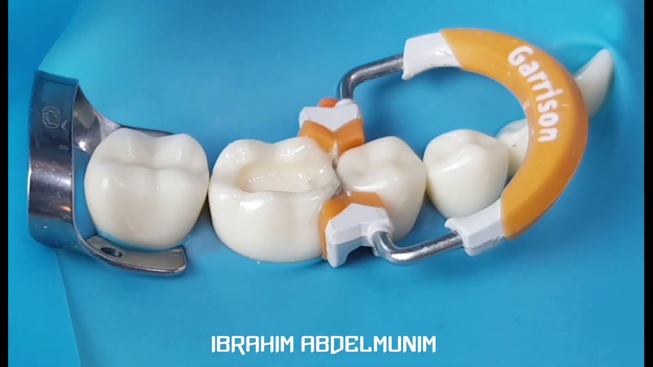 Ring Application - YouTube