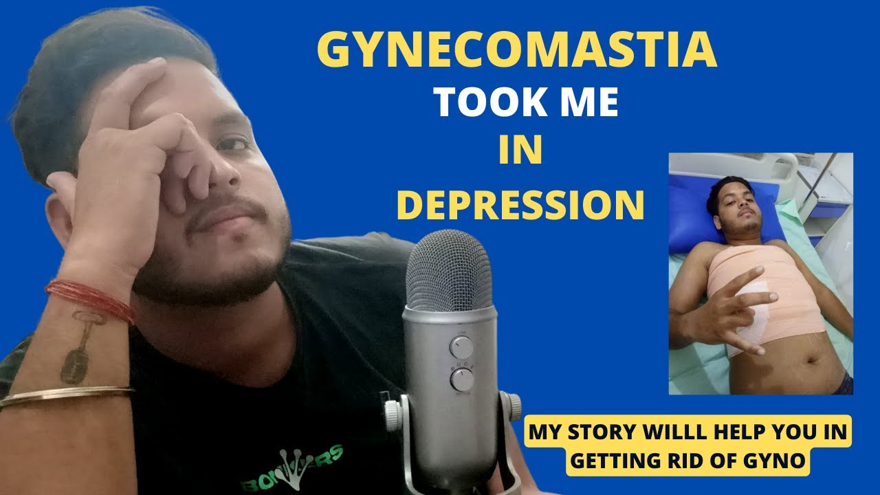 Gynecomastia & Depression (My Story) - Gynecomastia Surgery experience ...