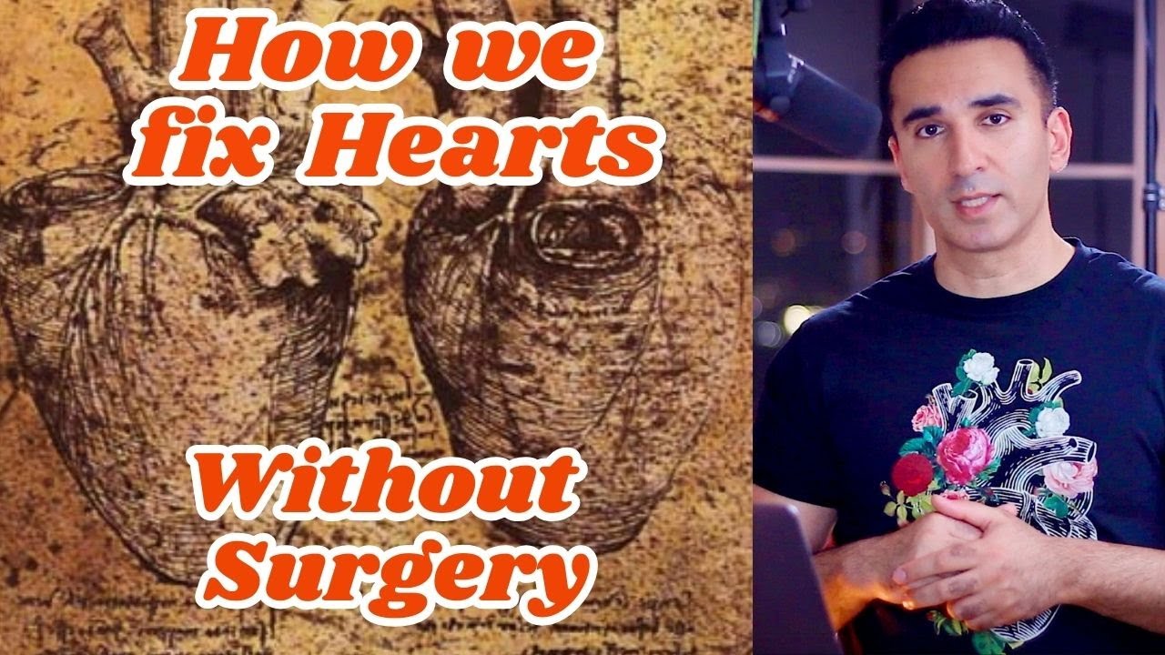 What is "Structural Interventional Cardiology"? - YouTube