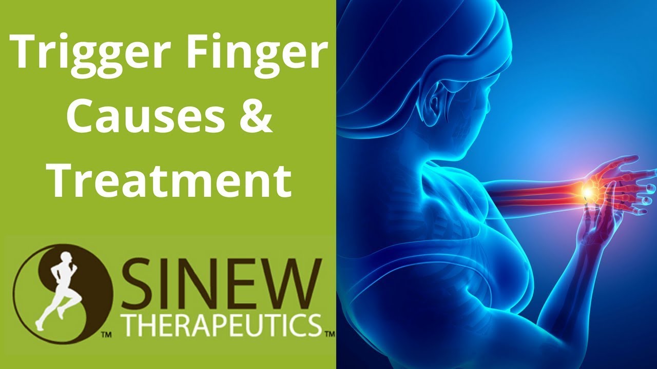 Trigger Finger Causes And Treatment Youtube
