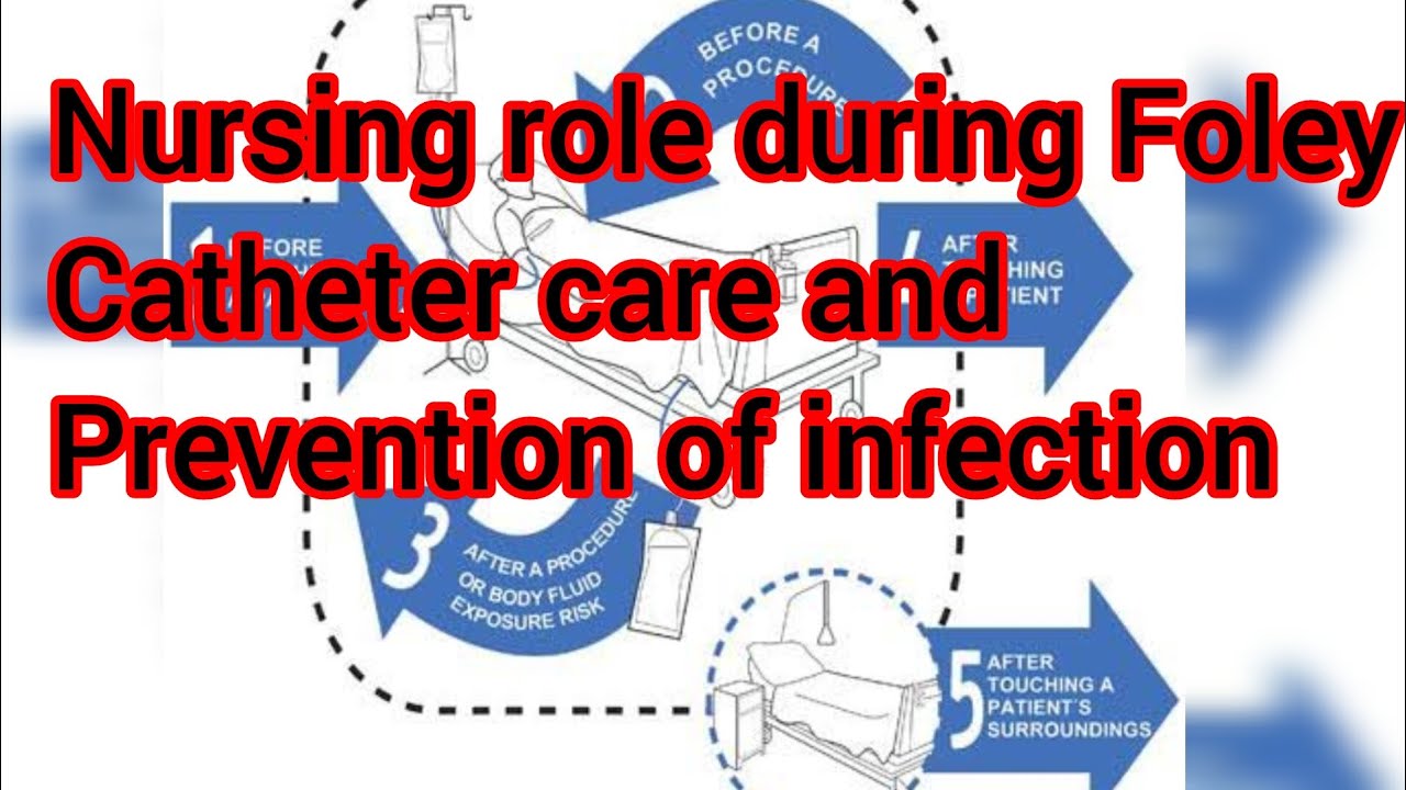 Nursing role during Foley catheter care and prevention of infection # ...