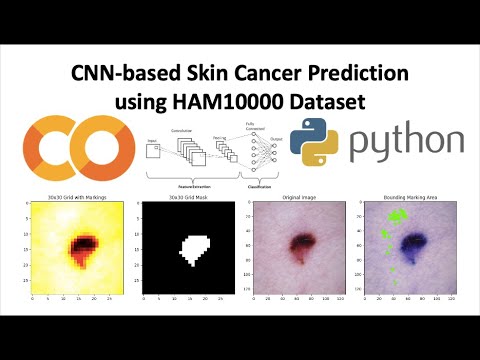 Skin Cancer Prediction using HAM10000 Dataset CNN-based EfficientNetB0 - YouTube