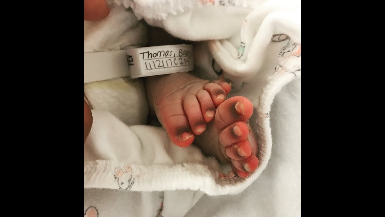 MY STILLBIRTH STORY | PART 2 - YouTube