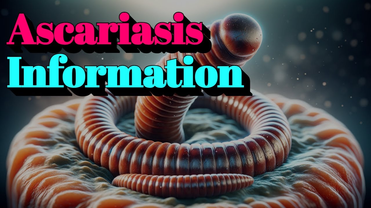 Ascariasis Information (🔬Tier.4 Infectious Disease) - YouTube