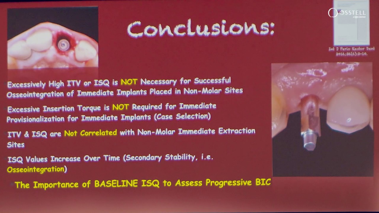 Using ISQ trend over time to confirm osseointegration - YouTube