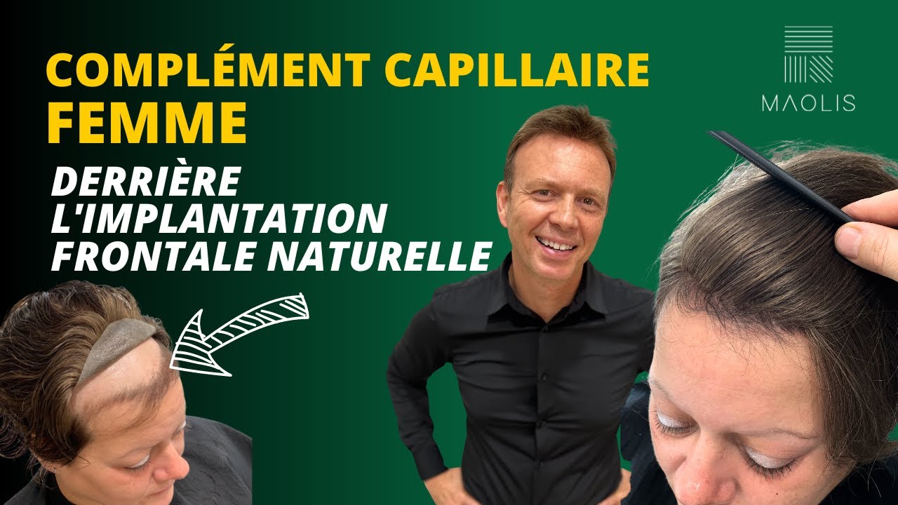 complément capillaire perruque pour femme collé Maolis - YouTube