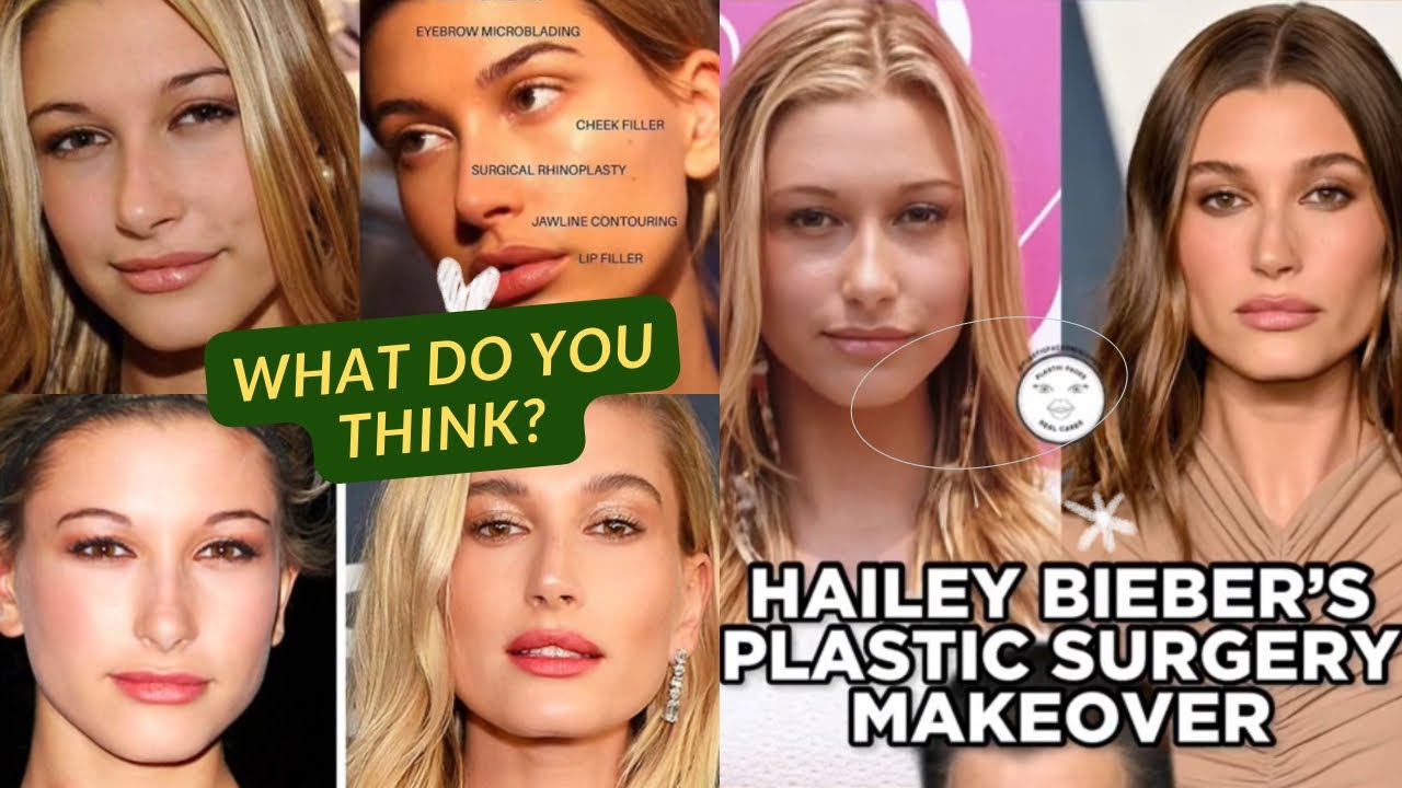 Doctors opinion about Hailey Bieber’s plastic surgery makeover - YouTube