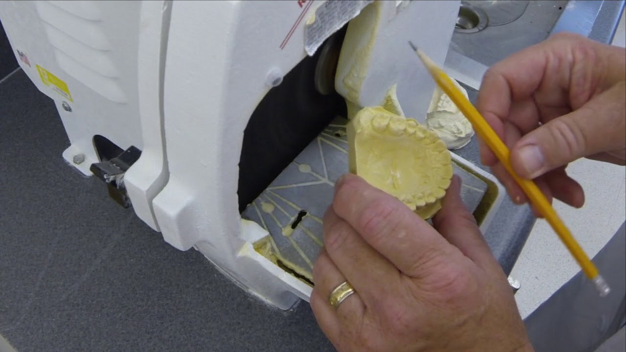 Occlusion Model Trimming - YouTube