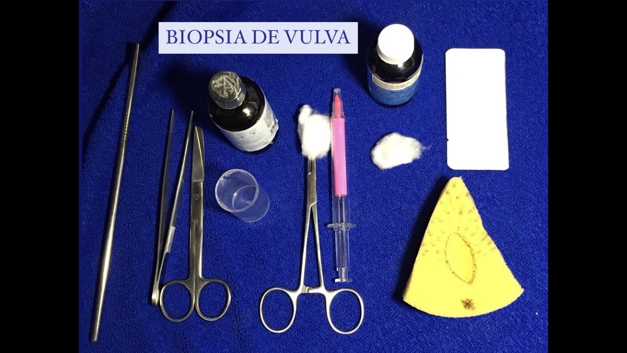 Biopsia de vulva - YouTube