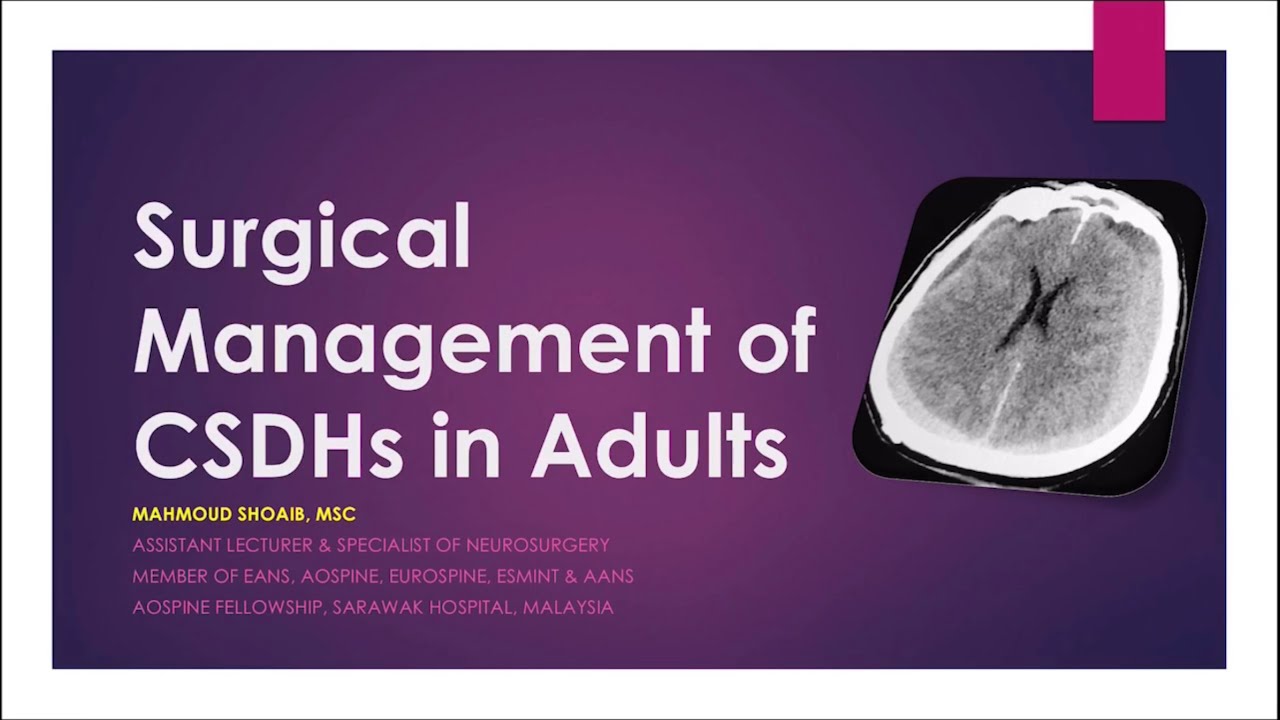 Surgical Management of CSDHs in Adults - CSDHs 2 - YouTube