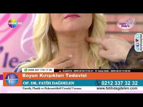 Op.Dr. Fatih Dağdelen - Boyun Kırışıkları Tedavisi