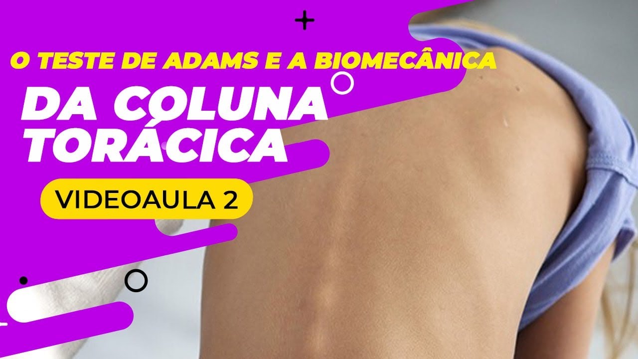 Videoaula 2 - O teste de Adams e a biomecânica da coluna torácica ...