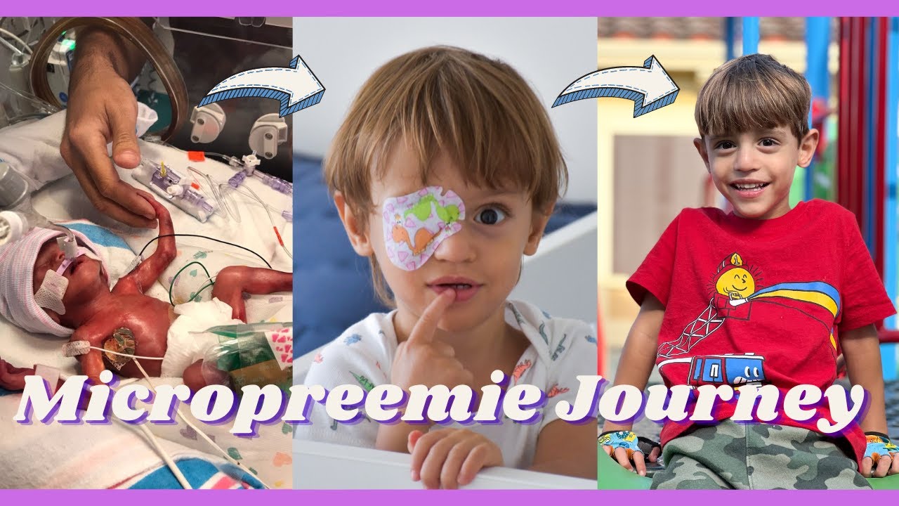Micropreemie Journey: 25 weeker to 5-year-old - YouTube