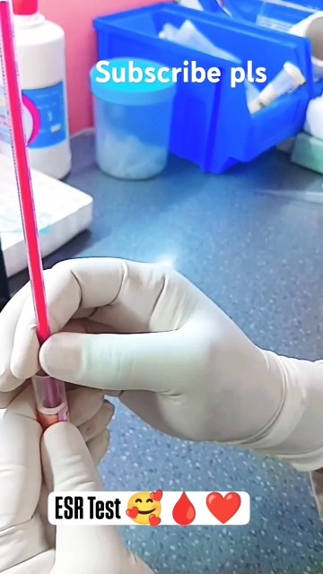 Lab technician 🥼🩺💉 ESR test #hospital #status #shorts #pathology # ...