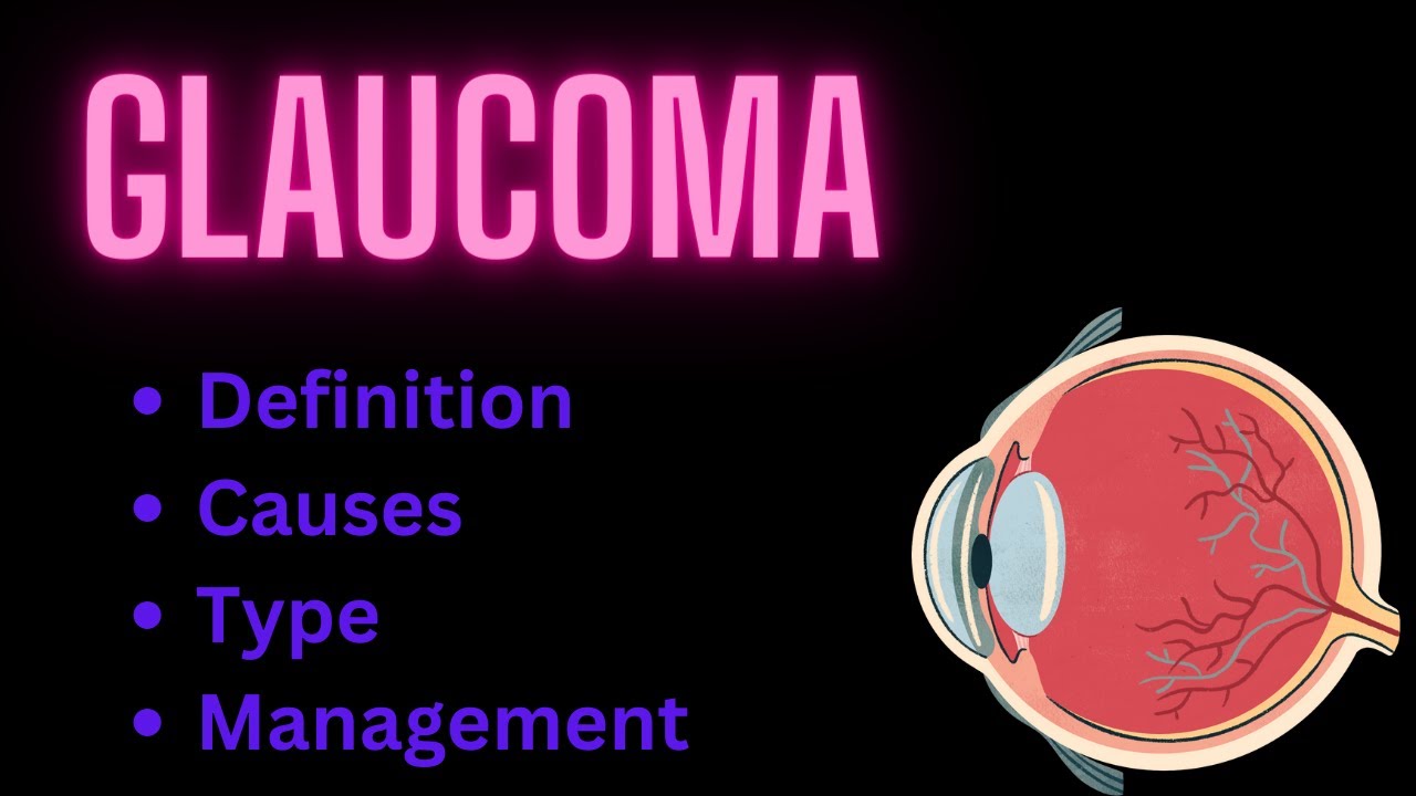II Glaucoma II All About Glaucoma - YouTube