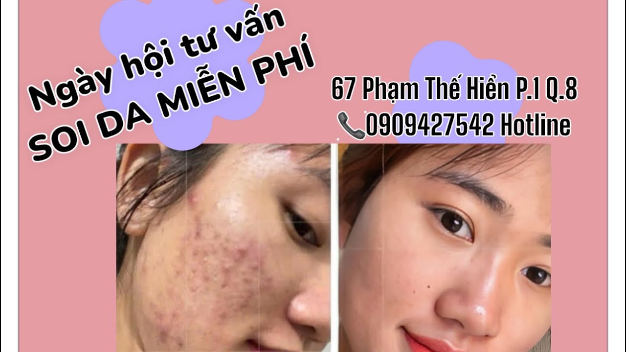 Tặng SUẤT CẤY TRẮNG DA & SOI DA Miễn phí tại 67 Phạm Thế Hiển P.1 Quận ...