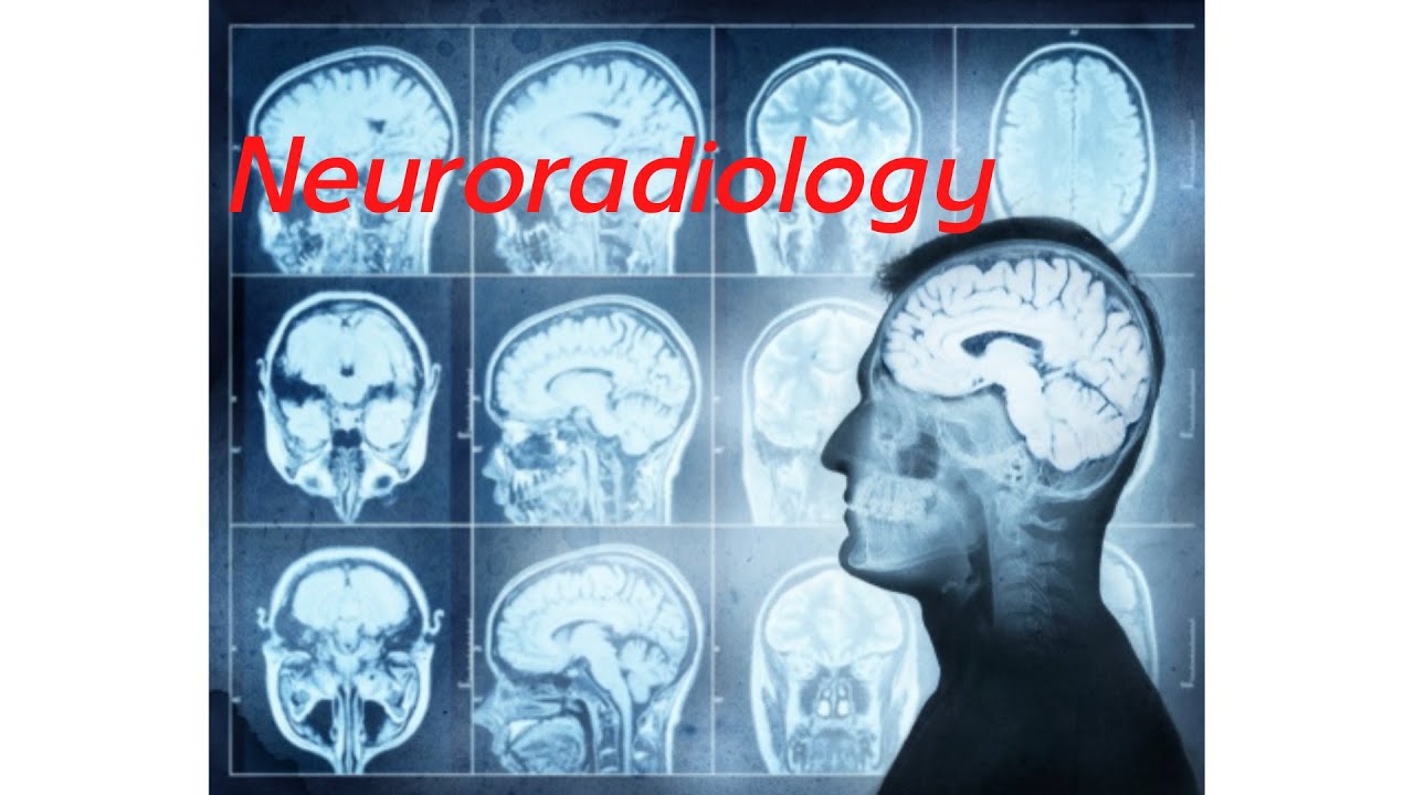 Radiology - Neuro - YouTube