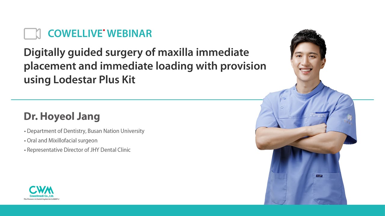 Digitally guided surgery of maxilla immediate placement and immediate ...