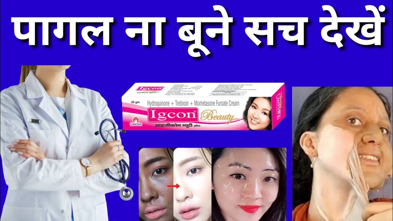 honest review igcon beauty cream, गोरेपन के लिए कैसे यूज करें,igcon ...