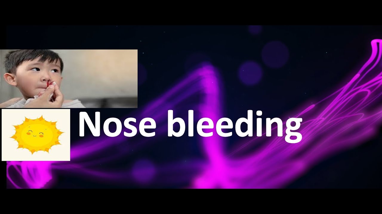nose bleeding - YouTube