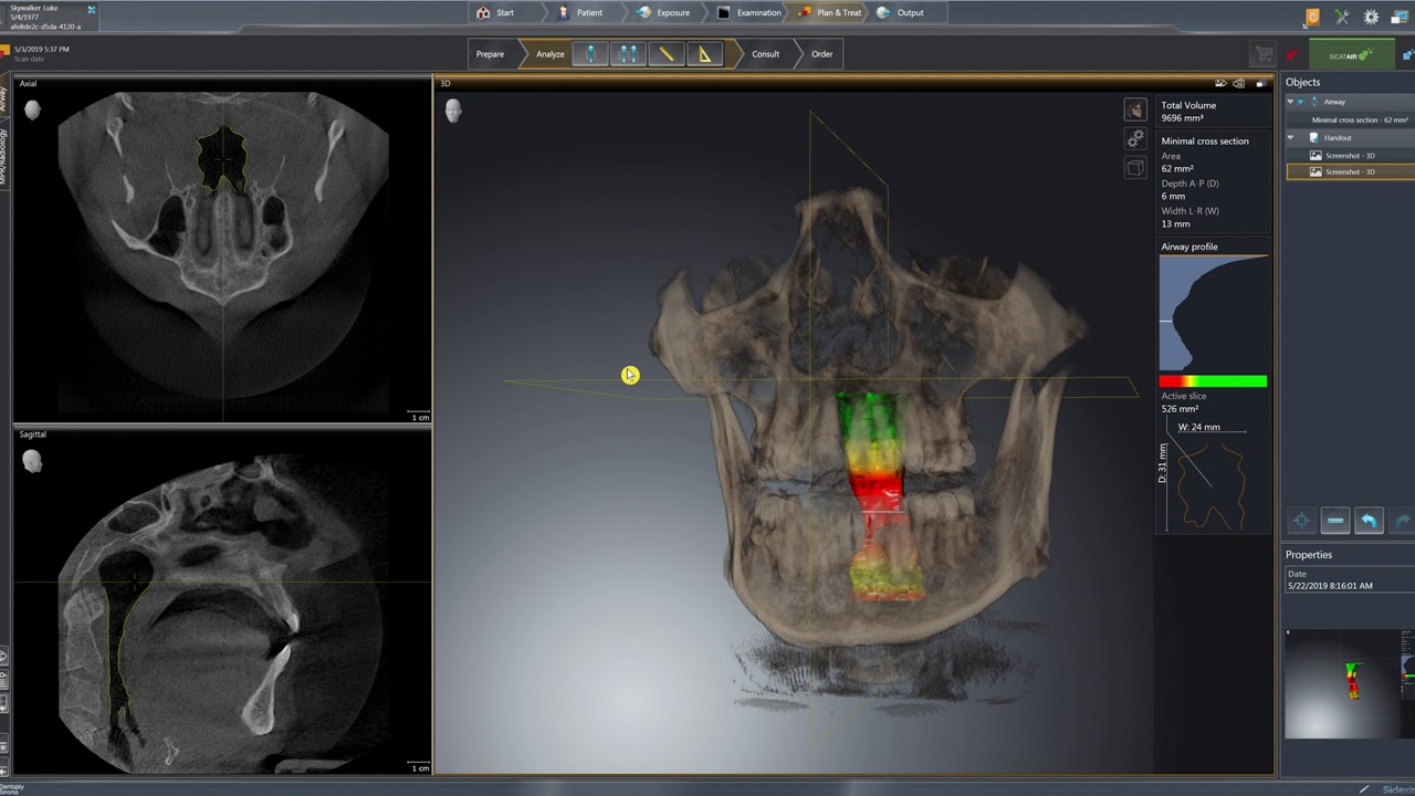 SICAT Air Tutorial 3 - Analyze - YouTube
