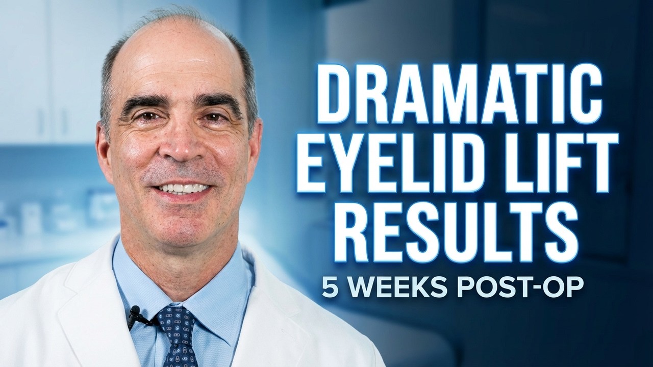 Skin Resurfacing and Upper Eyelid Lift | See the Results - YouTube