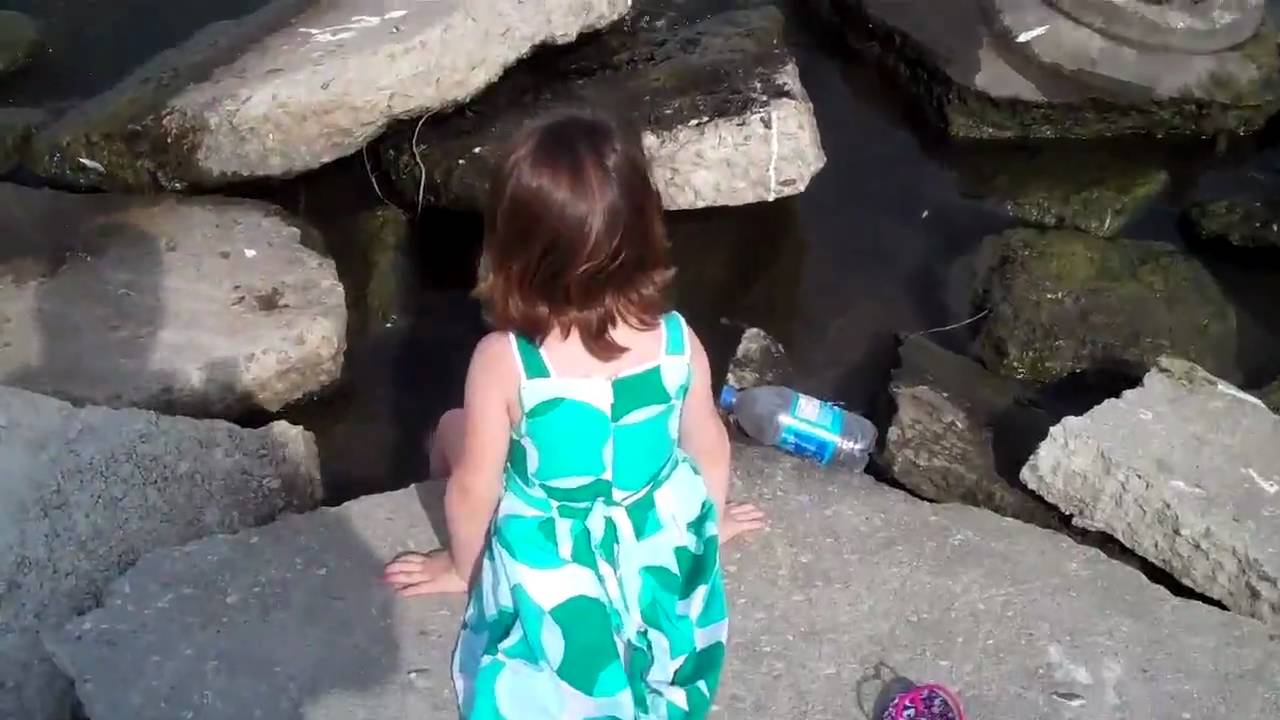 She has poop on her leg (7-12-10 Day 62) - YouTube