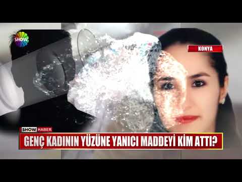 Genç kadının yüzüne yanıcı maddeyi kim attı?