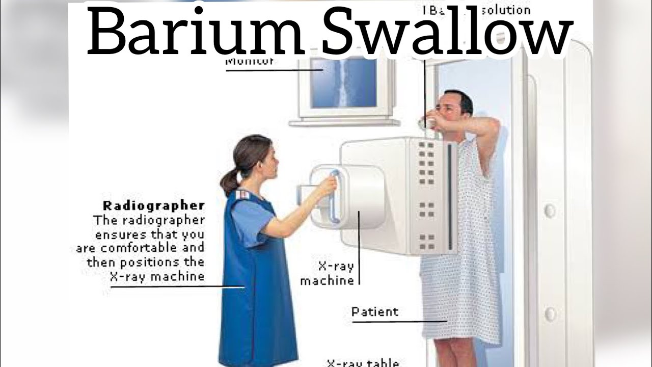 Barium Swallow Radiographer Radiology Information YouTube Barium Swallow Radiographer Radiology Information YouTube