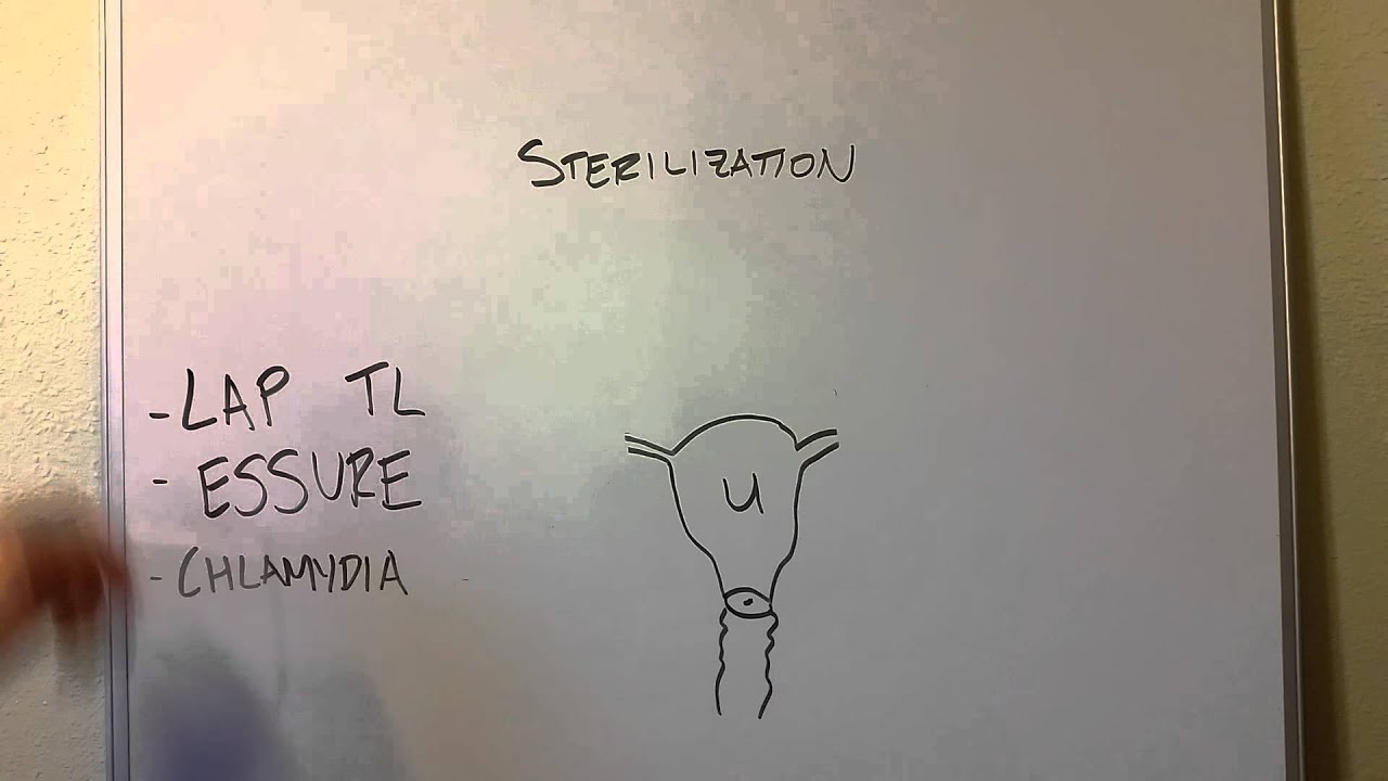 Tubal Ligation: Female Sterilization/Permanent Birth Control - YouTube