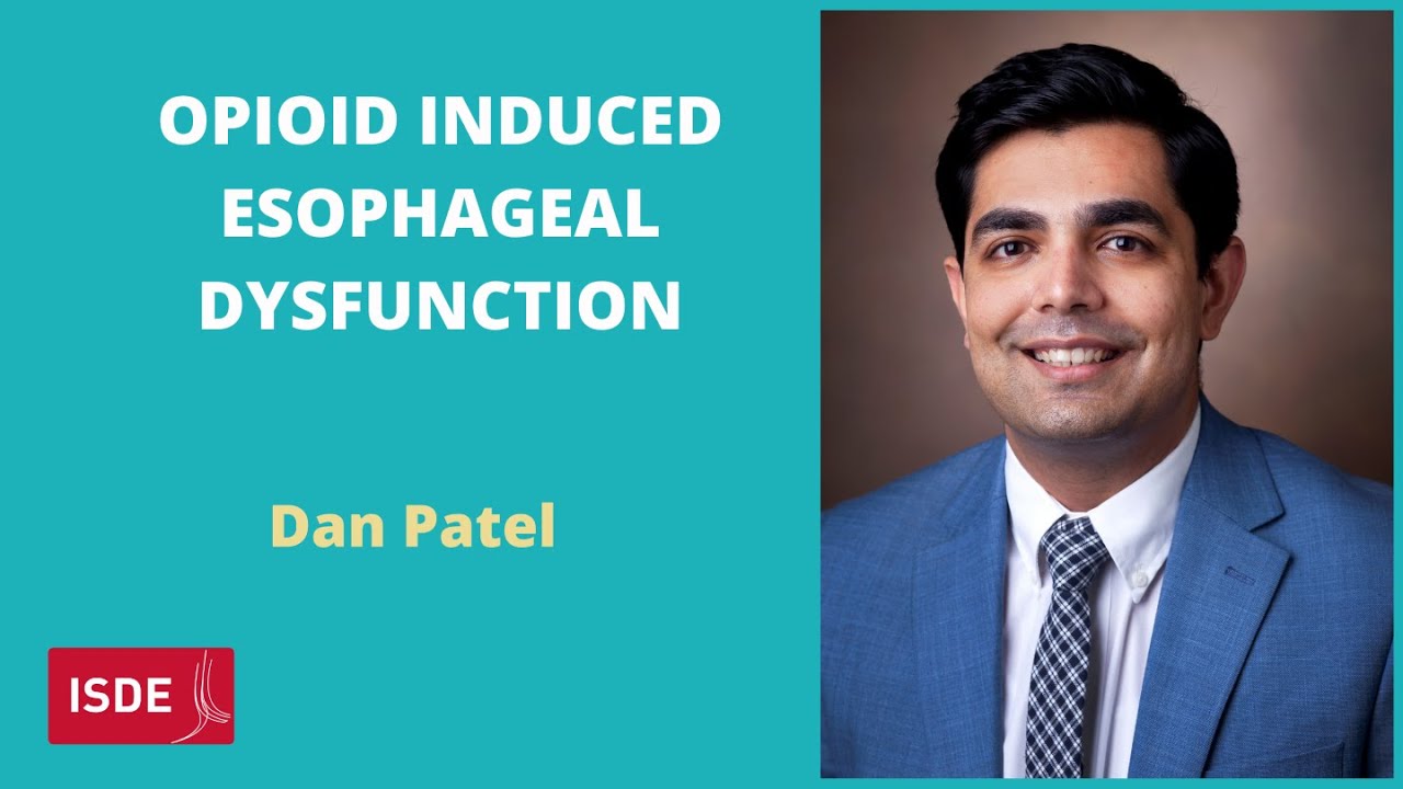 Opioid induced esophageal dysfunction - Dan Patel - YouTube